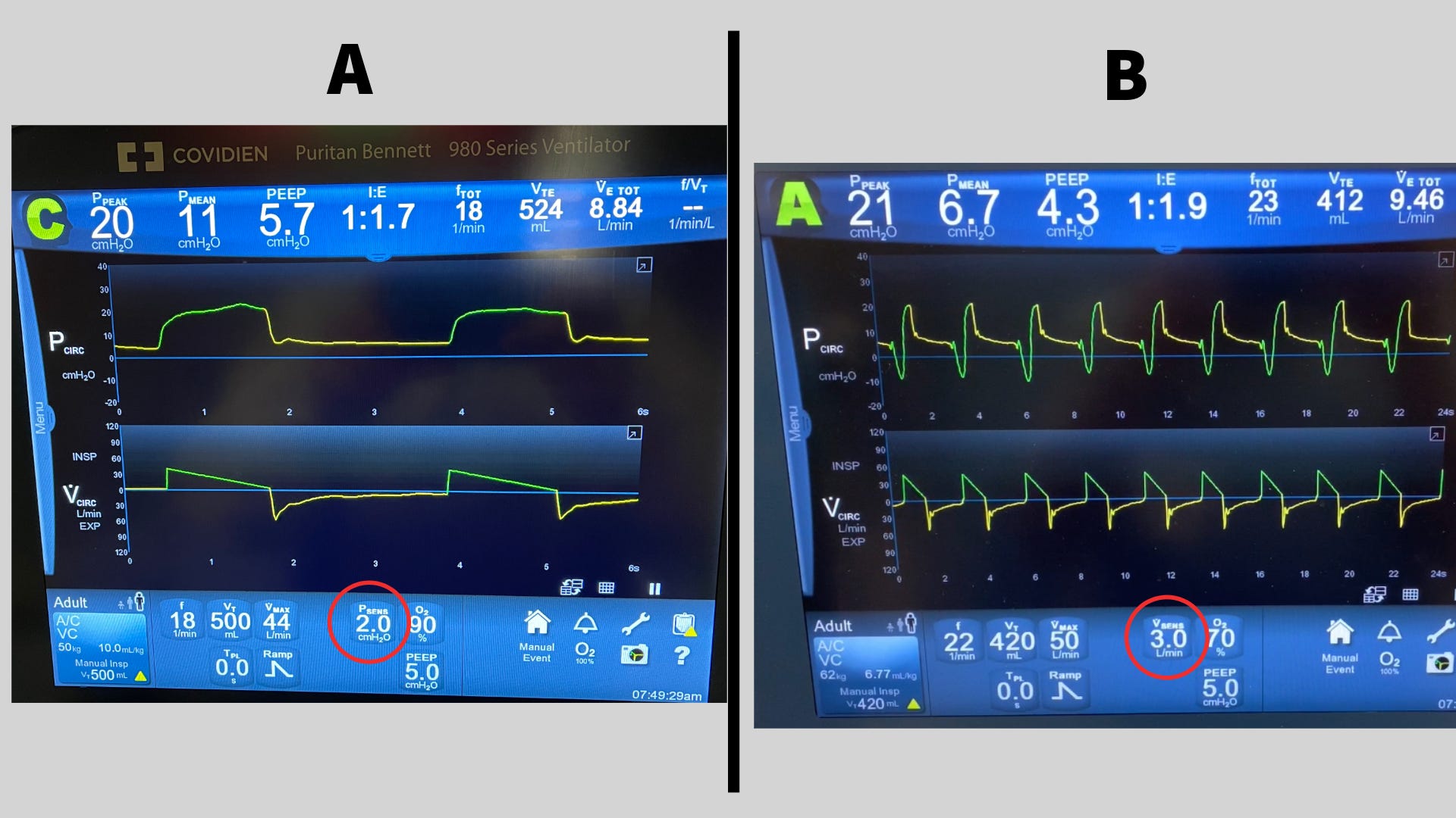 Mechanical Ventilation Made Simple: 9 Concepts Every Non-ICU Doc Should ...
