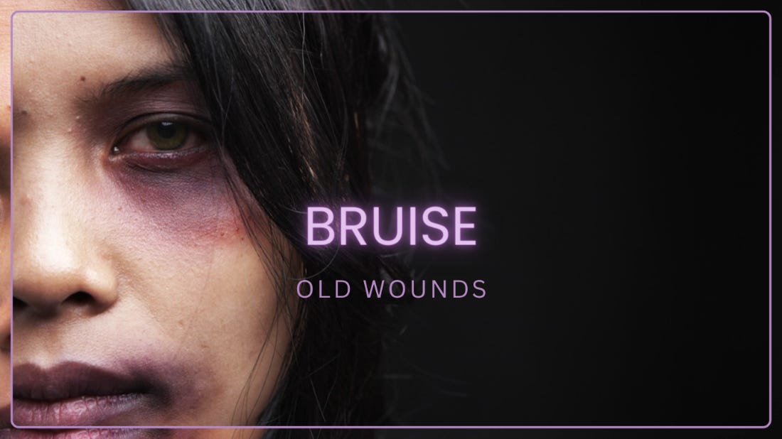Bruise - by Caro Henry - Caro’s Writing Perspectives