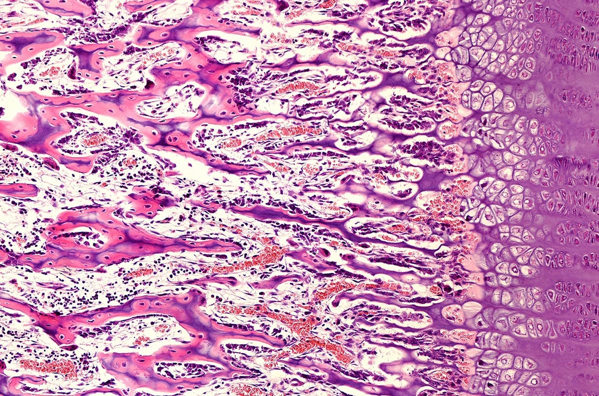 Hemoglobin in Cartilage Cells - by Sandy W. Lawrence