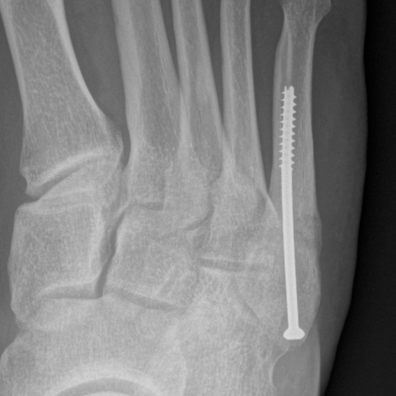 Orthopedic Hardware - Part 1 - by Alexander Baxter