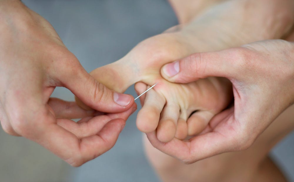 Splinters of the Soul - by Louisa Wah - Lily Pond