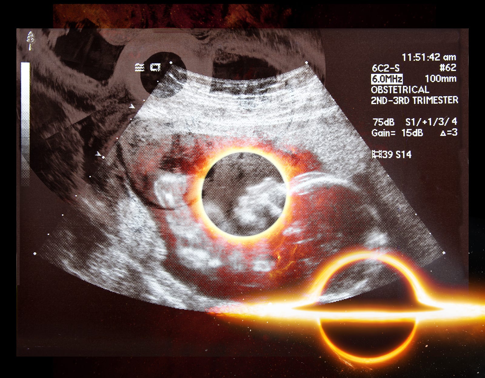 What Comes After the End of the Roe Era?