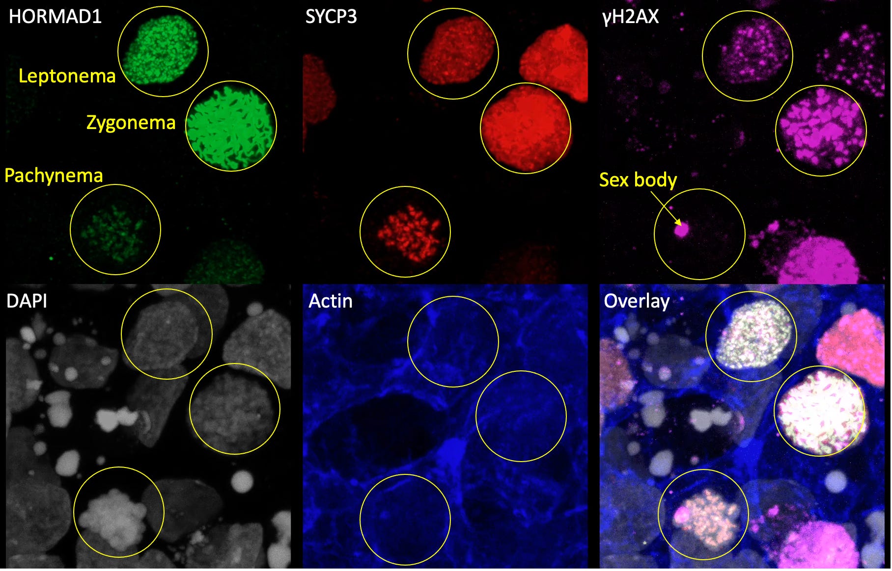 Meiosis Project Update: Preprint Edition! - by Metacelsus