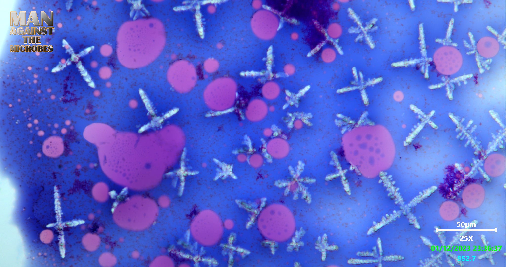 WoW! Staining of the swab solution show amazing chemical transitions ...