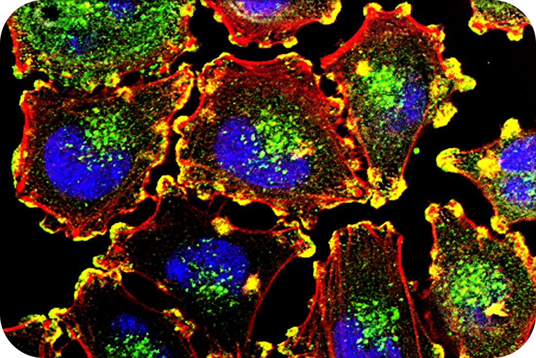 The FDA Approved Checkpoint Therapeutics' cSCC Drug and How it Compares ...