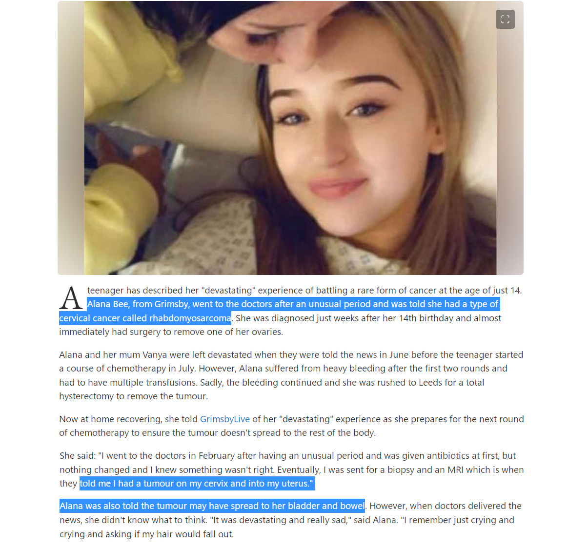 Dr. William Makis: Turbo Cancer in Children Ages 10-19. Sarcoma Link to ...