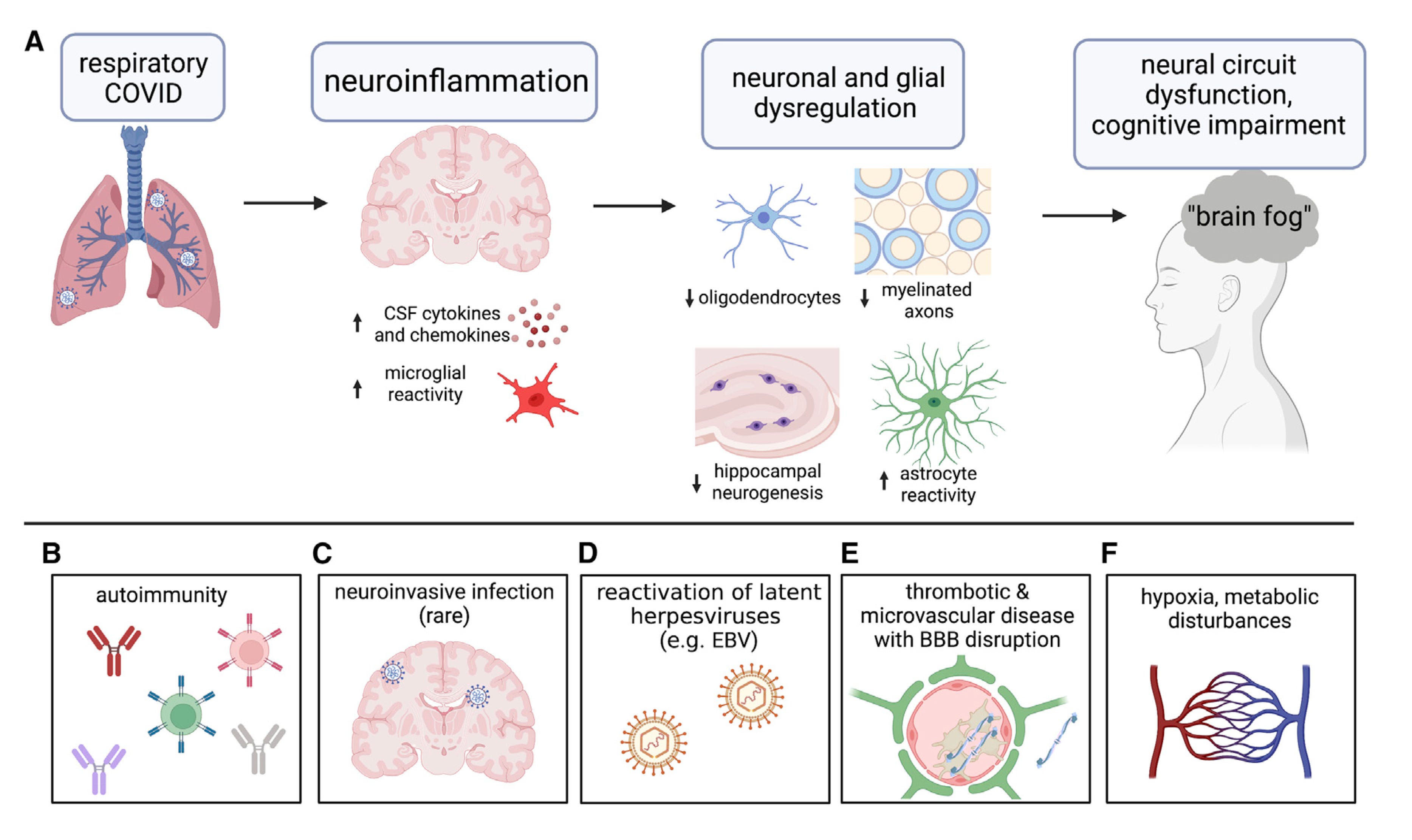The Brain and Long Covid - by Eric Topol - Ground Truths