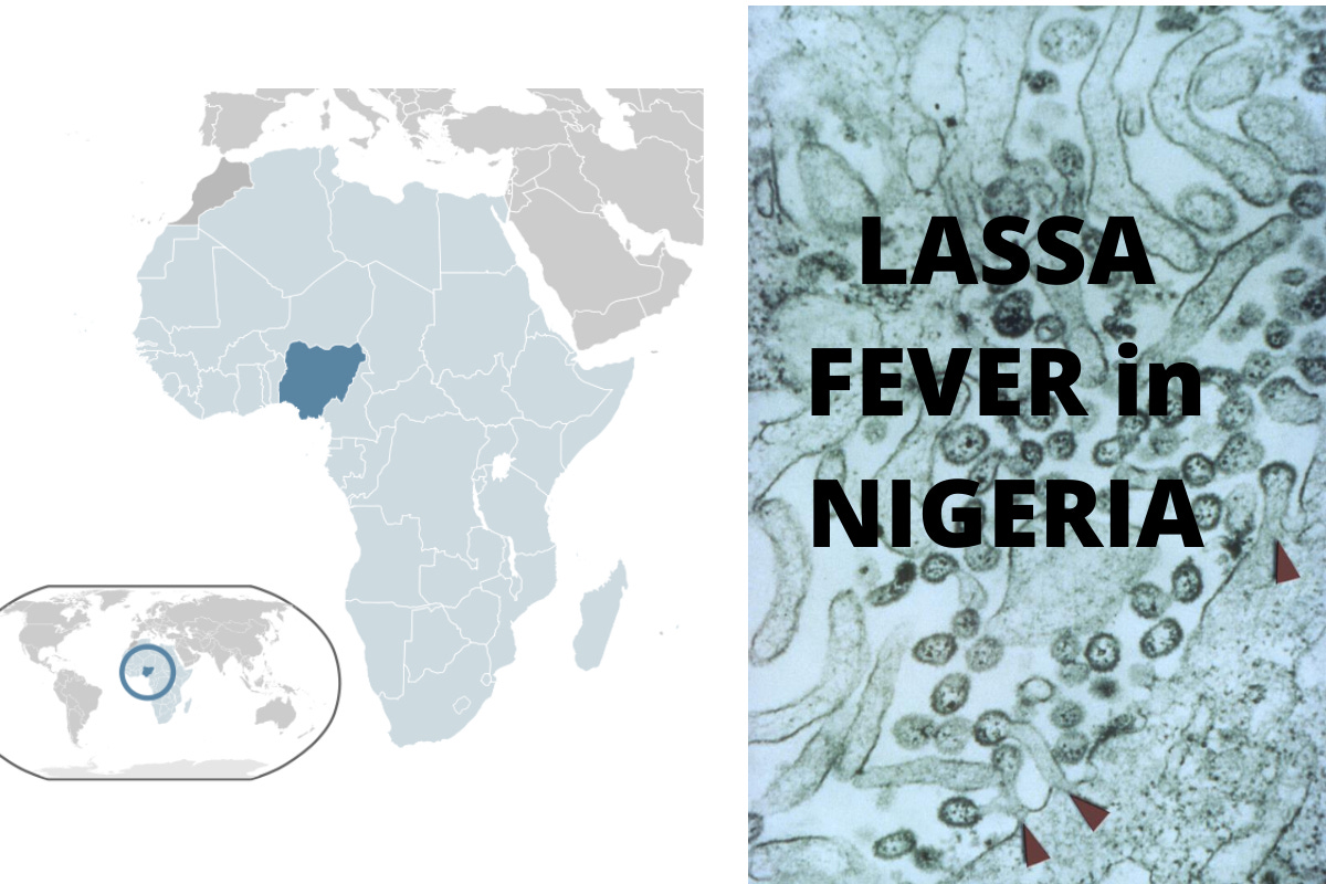 Nigeria reports rise in Lassa fever cases/deaths in 2023