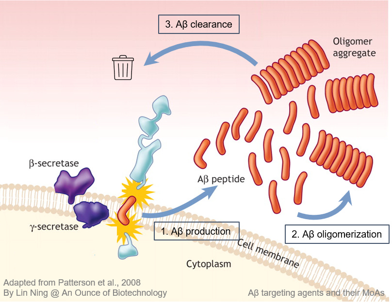 Are we getting closer to curing Alzheimer’s Disease?