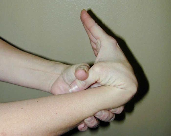 Ligamentous Laxity and Vaccine Injuries