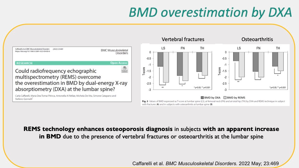 R.E.M.S. - by A Midwest Doctor