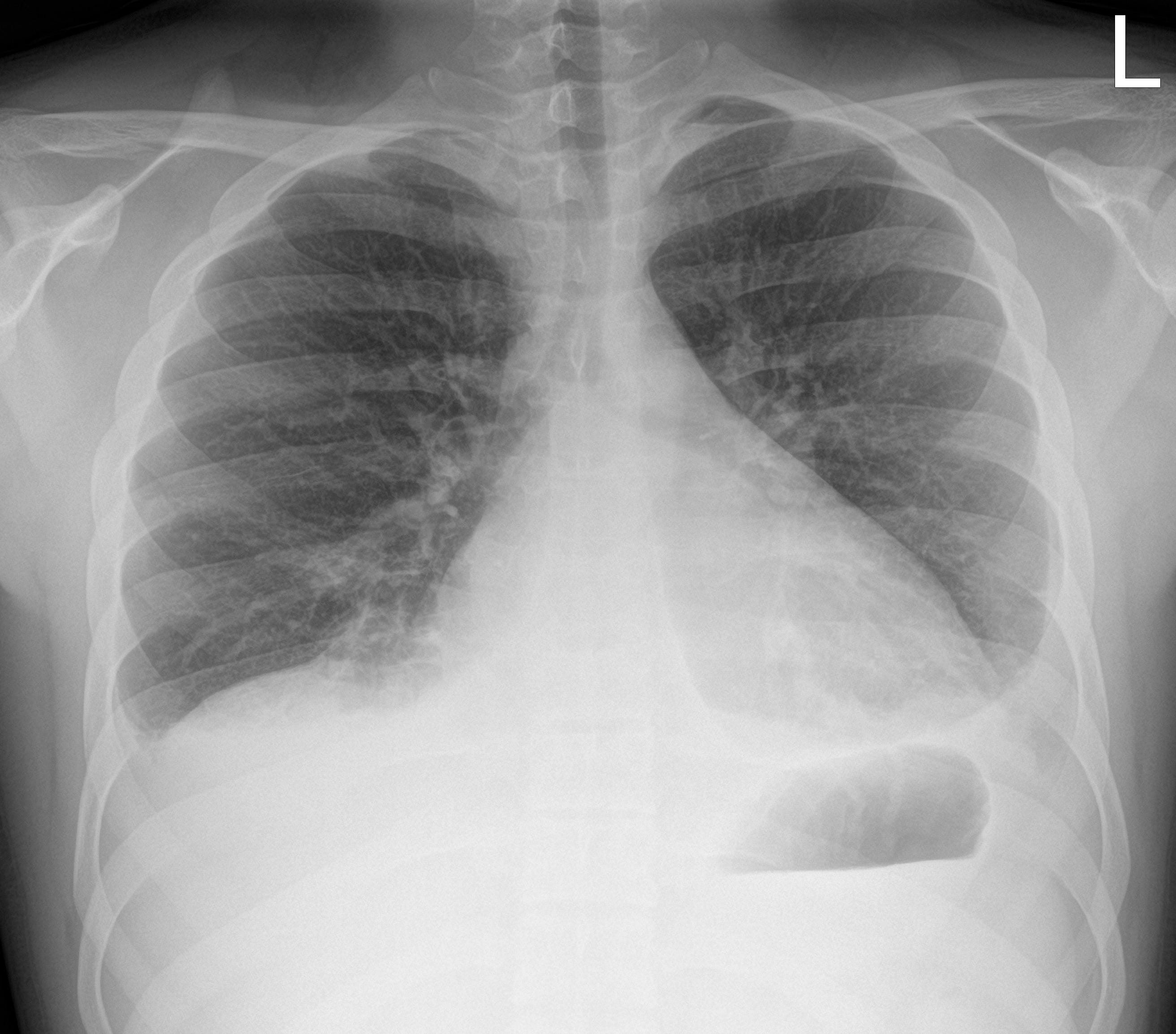 The Future of Heart Failure Care: AI and Predictive Medicine