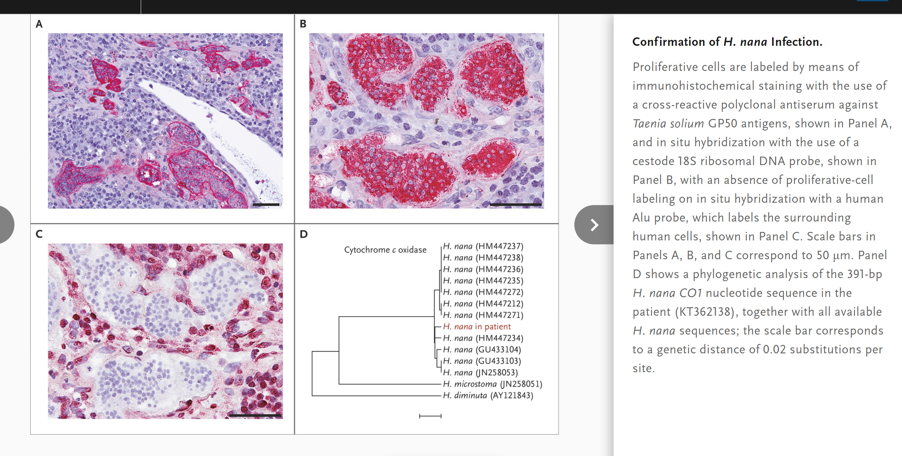 Cancer and Parasites - Tom Renz’s Newsletter