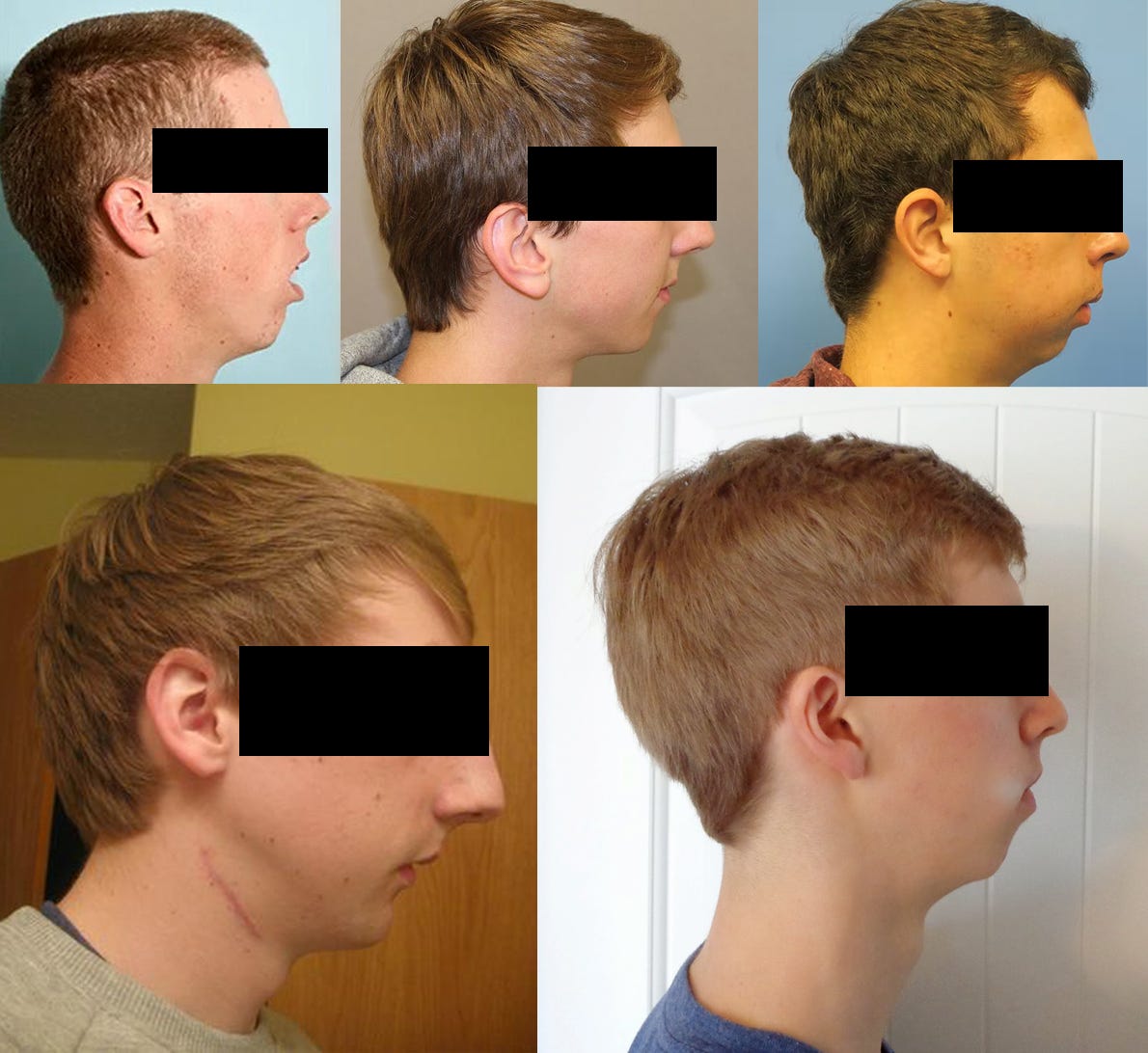 1.4 Expanding for Aesthetics Only - by Ronald Ead