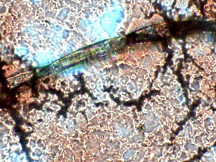 Early Obz: - Mz: Obz