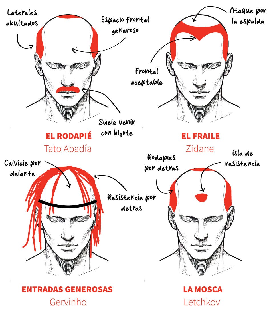 Lo que el fútbol nos ha enseñado a los calvos