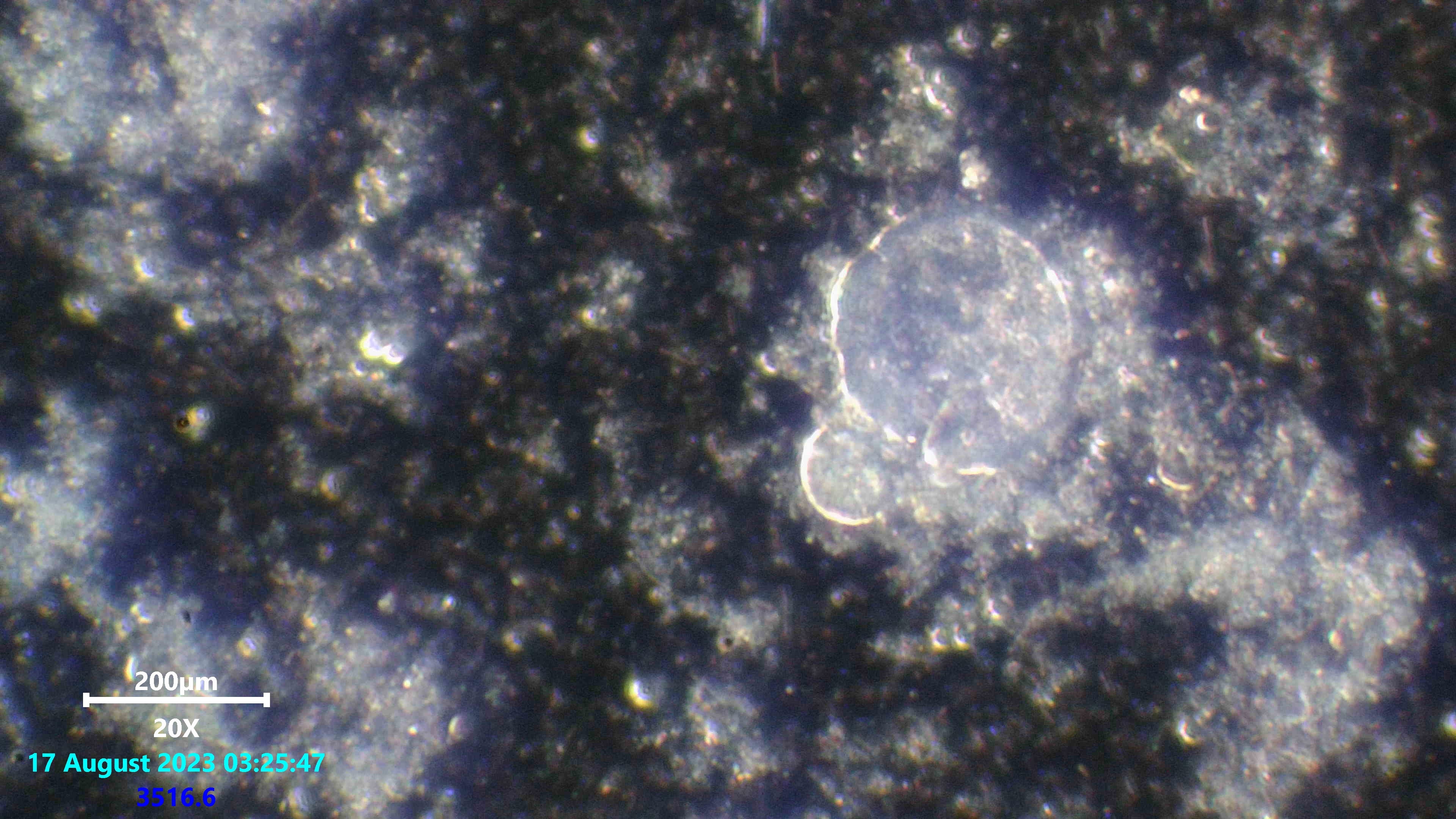 Stool sample shows UV reactive material and Q-dots.