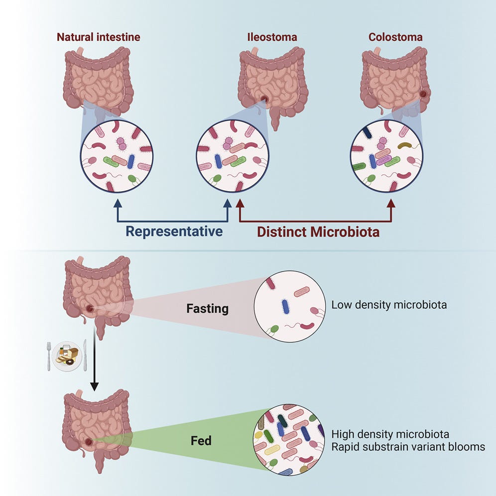Gut microbiota and colorectal cancer - by DoorlessCarp🐭