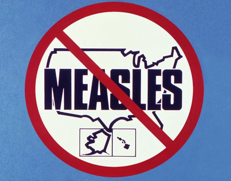 Measles and SSPE: Progressive, disabling, and fatal