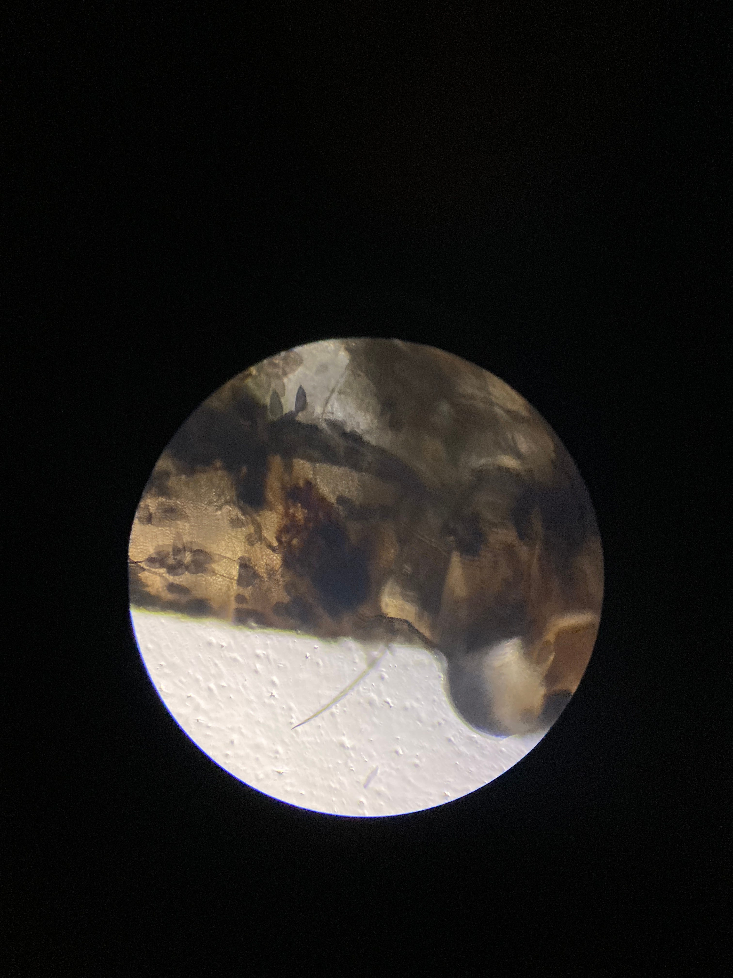 “Mosquito” under microscope - RebeccaccebeR’s Substack