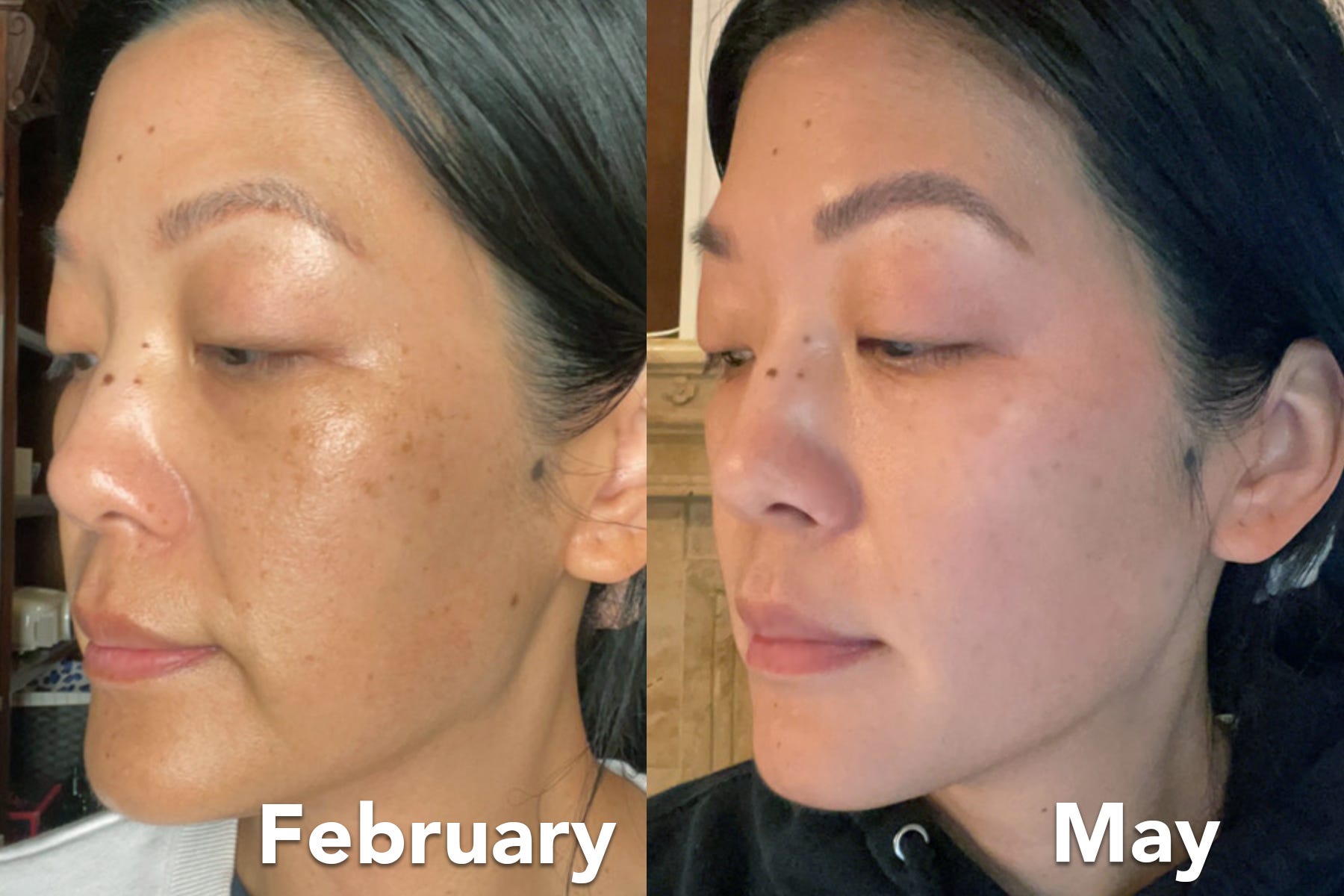 Out, Damned Dark Spots - by Michelle Lee - Go Ahead, Try Me