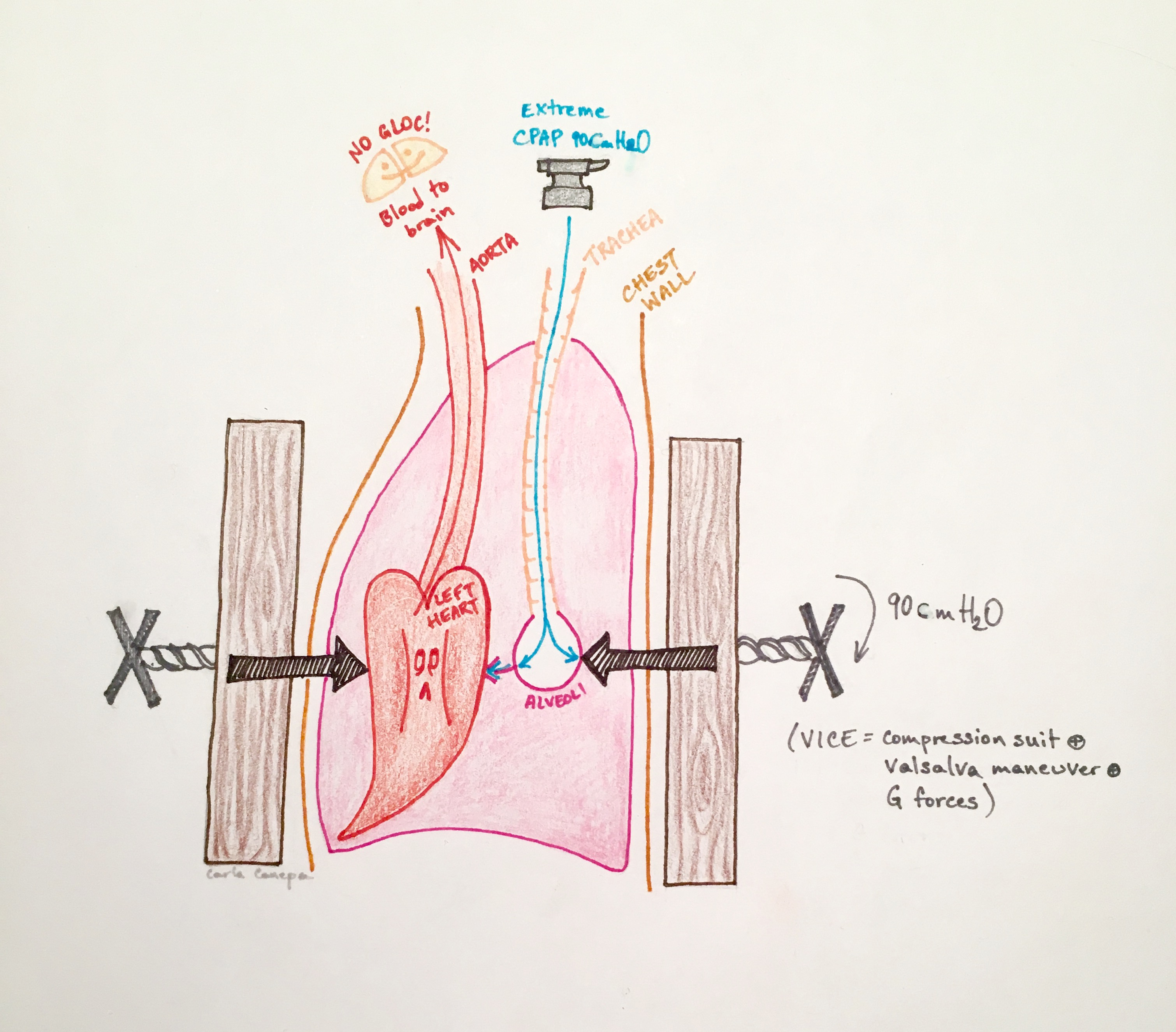 ICU Physiology in 1000 Words: Fighter Pilots!