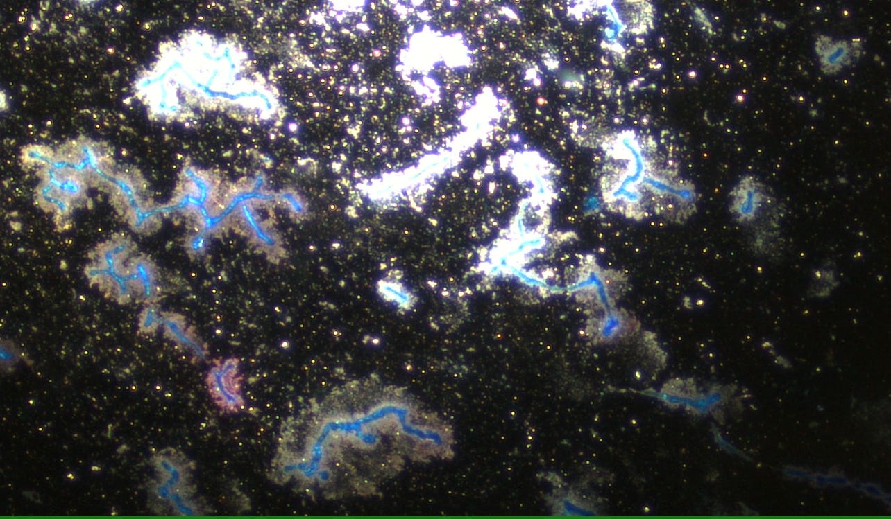 Methylene Blue Binds Hydrogel In Lantus Insulin - Lantus Insulin ...