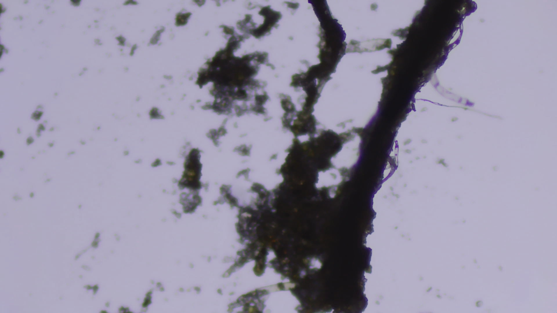 Homegrown Tomato Skin Stains Under The Microscope