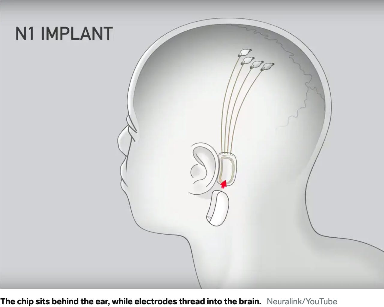 Neuralink: What you need to know - Murph Does It