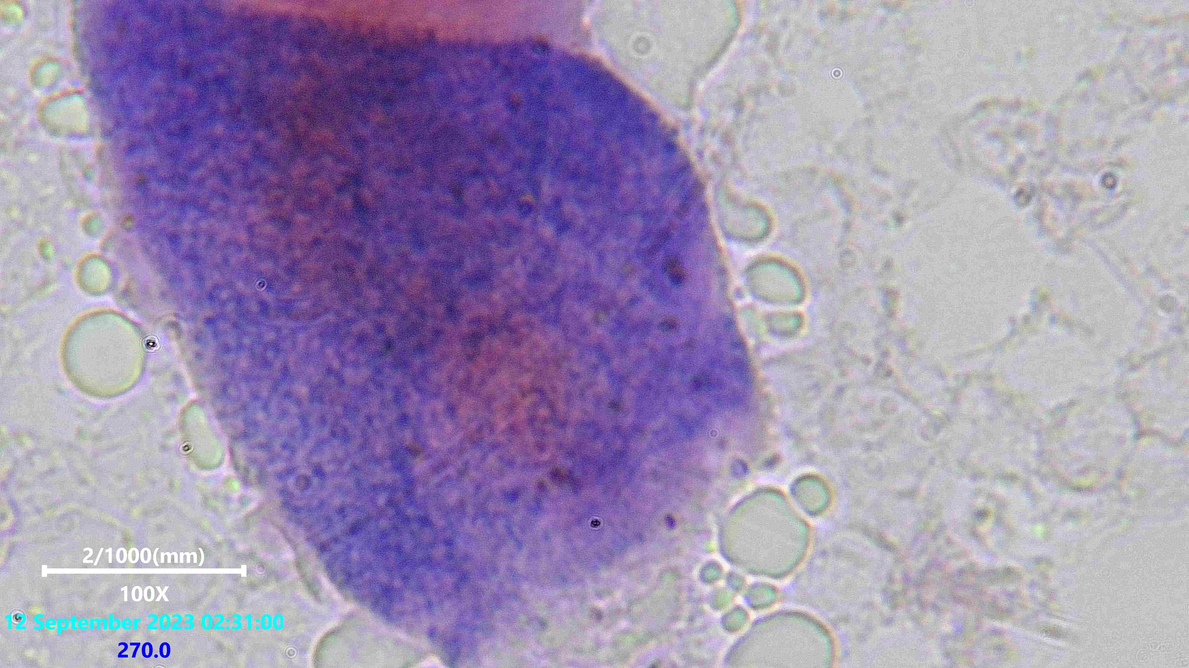 Gram staining of my blood reveals same abnormalities shown by ...