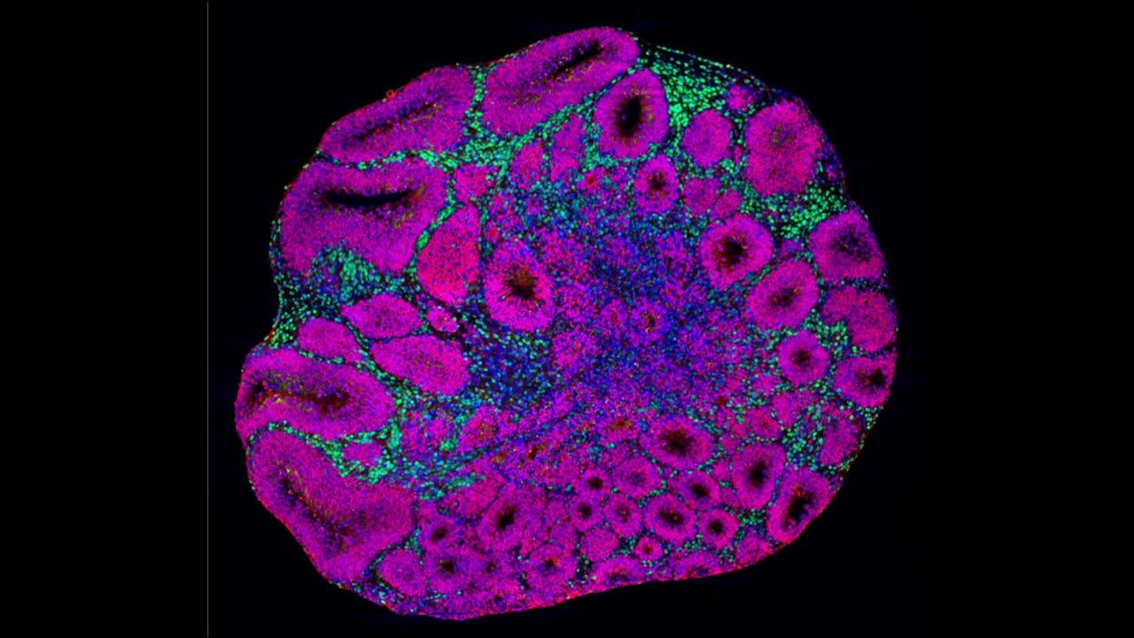 Brain Organoids: A Promising Tool for Clinical Neuropsychology