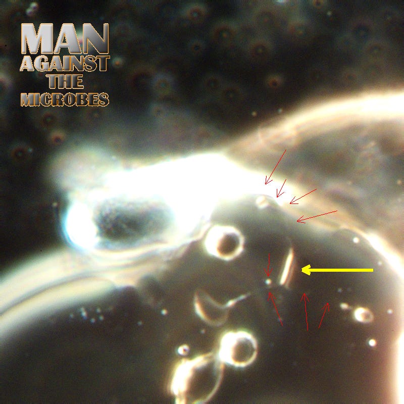 Bubbles In Blood Are Possibly Part Of An In Vivo Microfluidic System