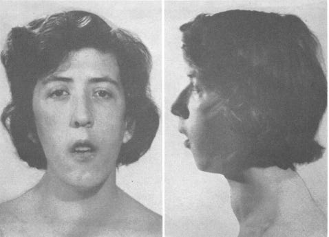 From Clinic to Genome and Back Again: Cowden Syndrome and PTEN