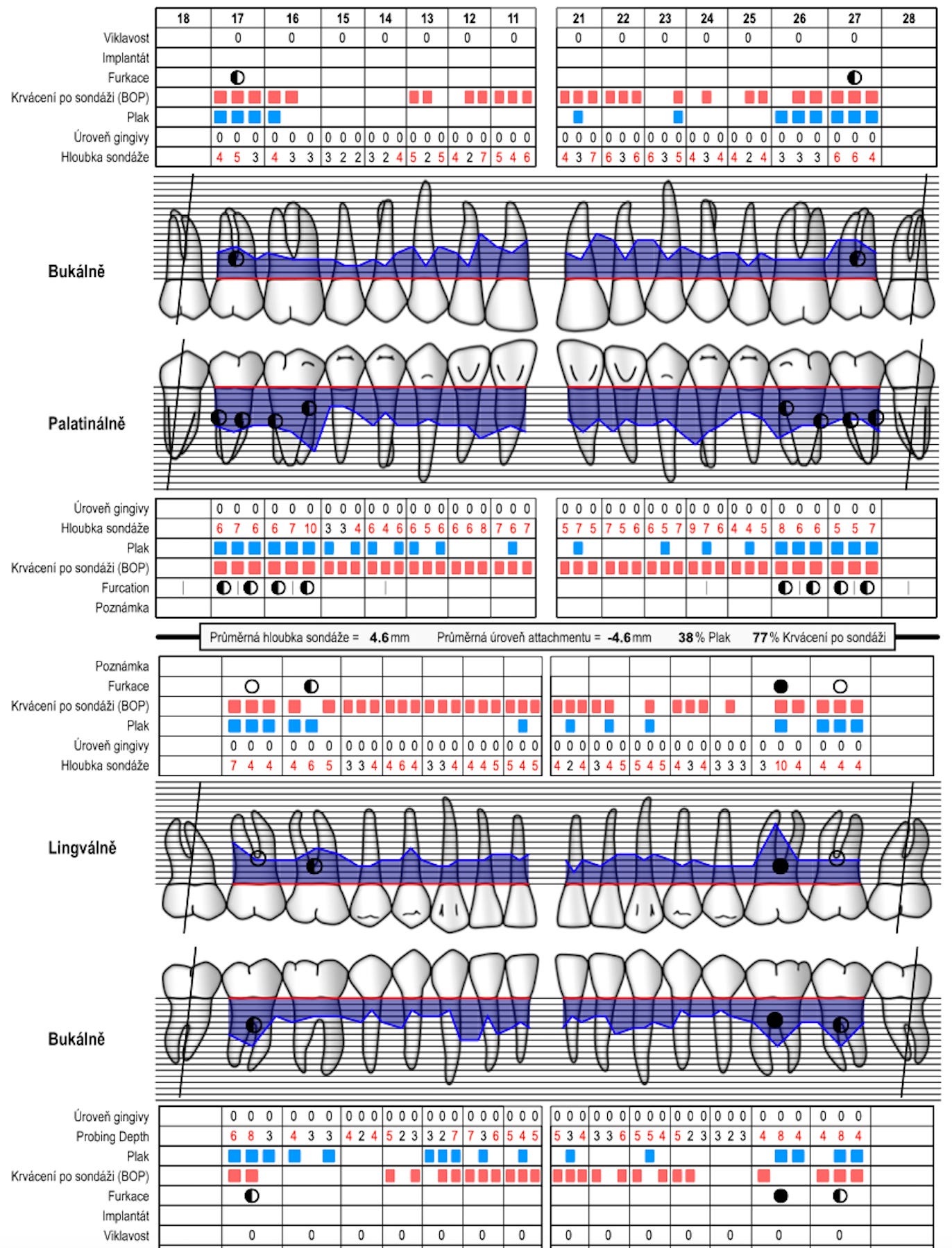 #24 Parodontitis: Grading