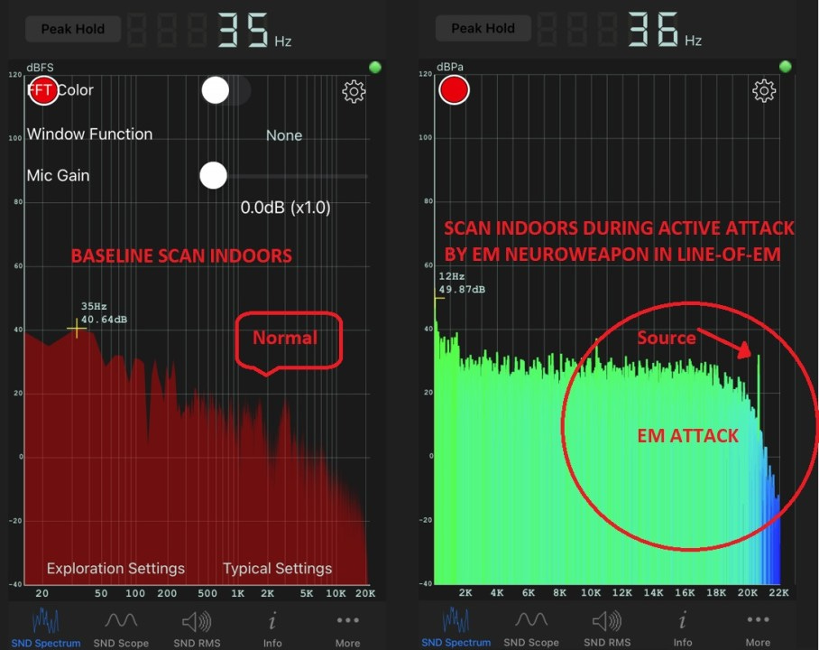 Neurohacking 404: Directed Energy Weapon (DEW) Recovery Information