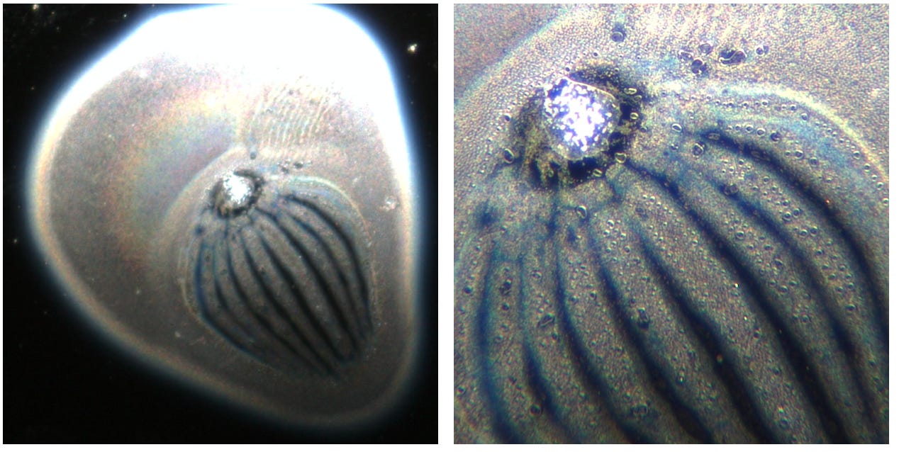 Calcium Disodium EDTA plus Ascorbic Acid Completely Inhibits Microchip And Nanoantenna ...