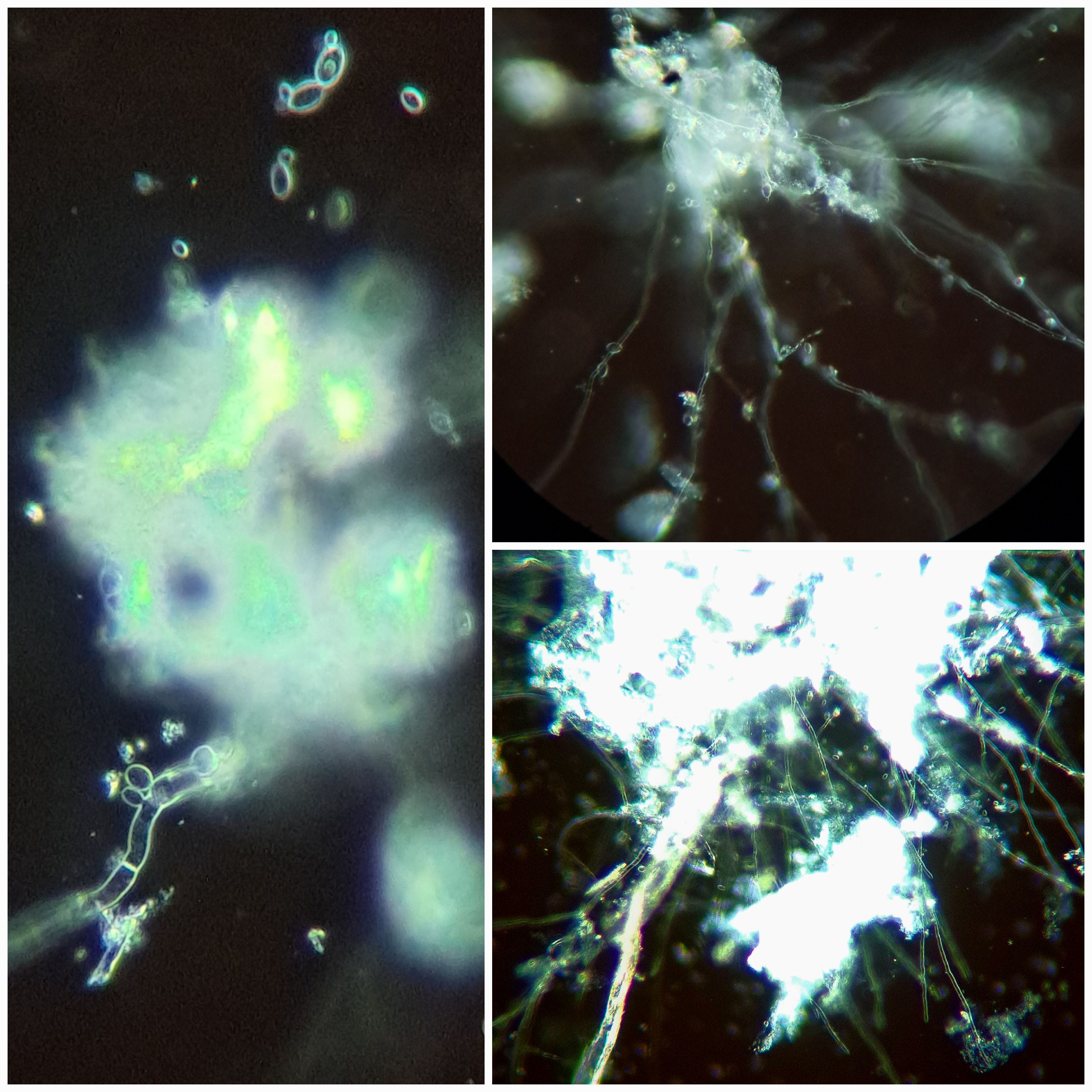 The AK snowmelt - Will: Micronaut