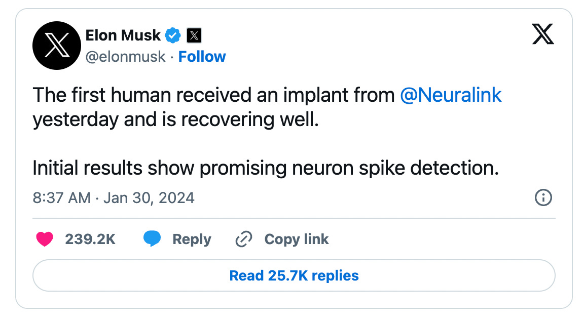 What Neuralink will actually do - by Suzi Travis