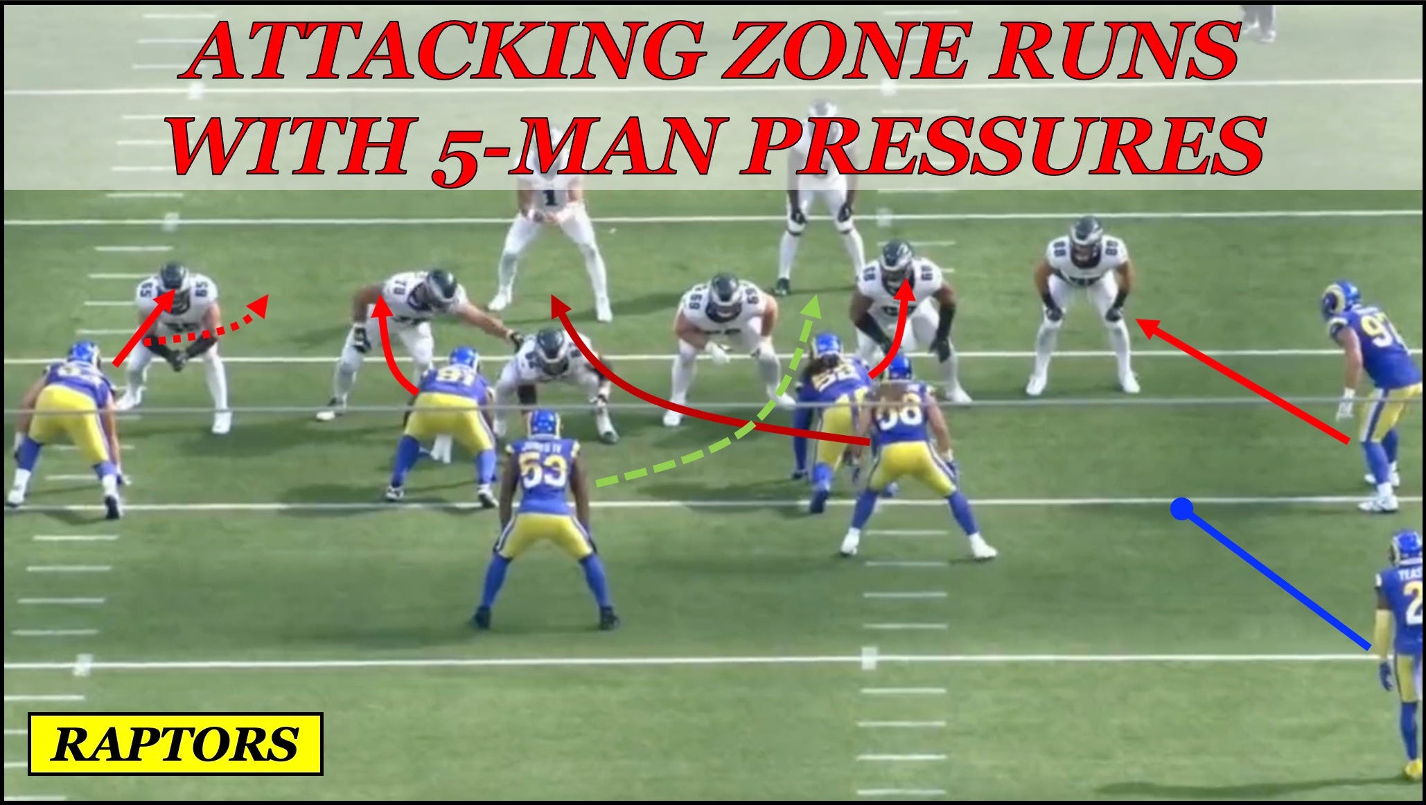 Attacking Zone Runs with 5-Man Pressures - MatchQuarters