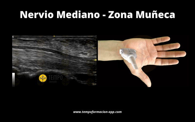 Nervio mediano - Parte 1 - by Tempo Formación