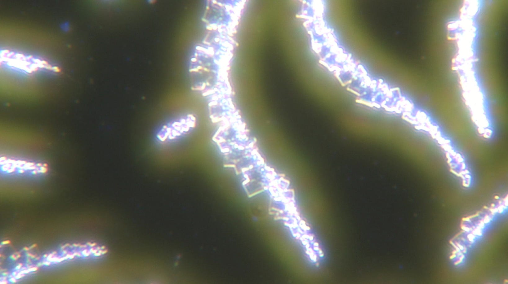 Darkfield Microscopy Of Pfizer's Enbrel (Etanercept) Shows Nanoantennas ...