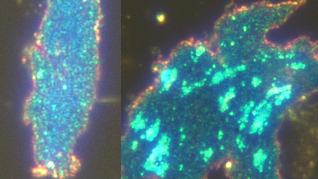 Massive Nano and Microrobot Activity In Pfizer BioN Tech COVID19 ...