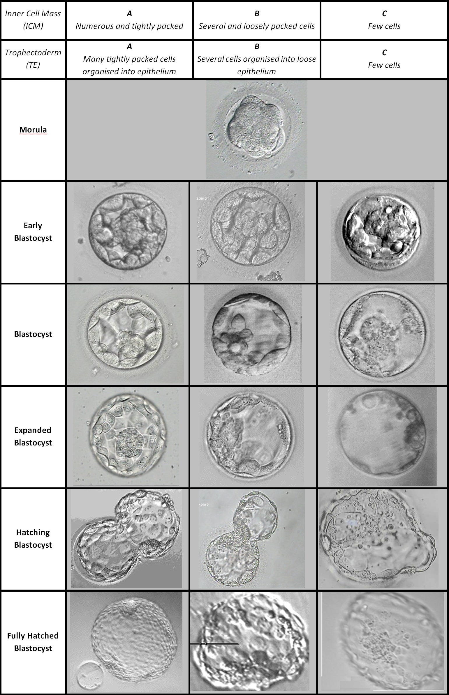 Can we pick the best sperm? - by Emil O. W. Kirkegaard