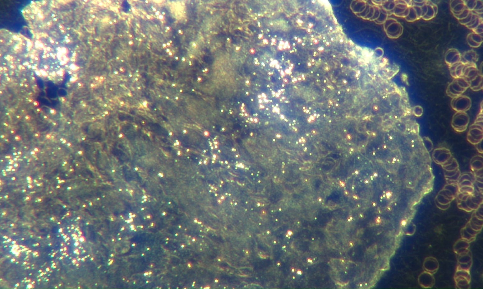 Darkfield Live Blood Microscopy Of A Discoid Mesogen Self Assembly ...