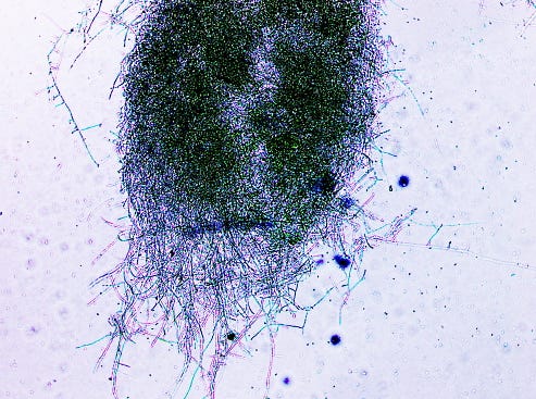 Blood Cultures of Unvaccinated Blood Shows Extensive (CDB) Filament ...