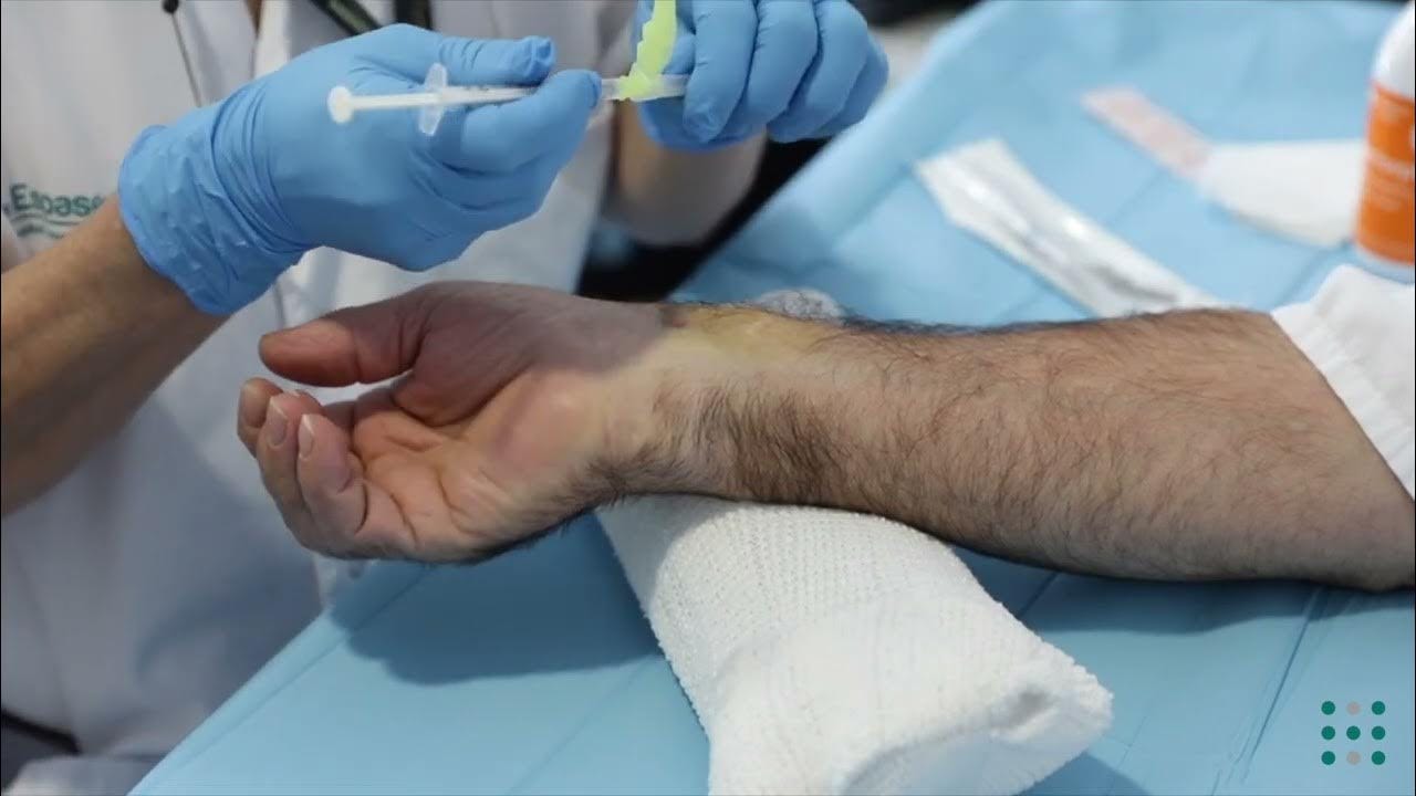 Interpretación de gasometría arterial