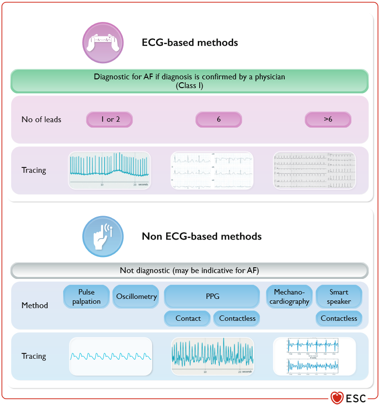 A diretriz de Fibrilação Atrial