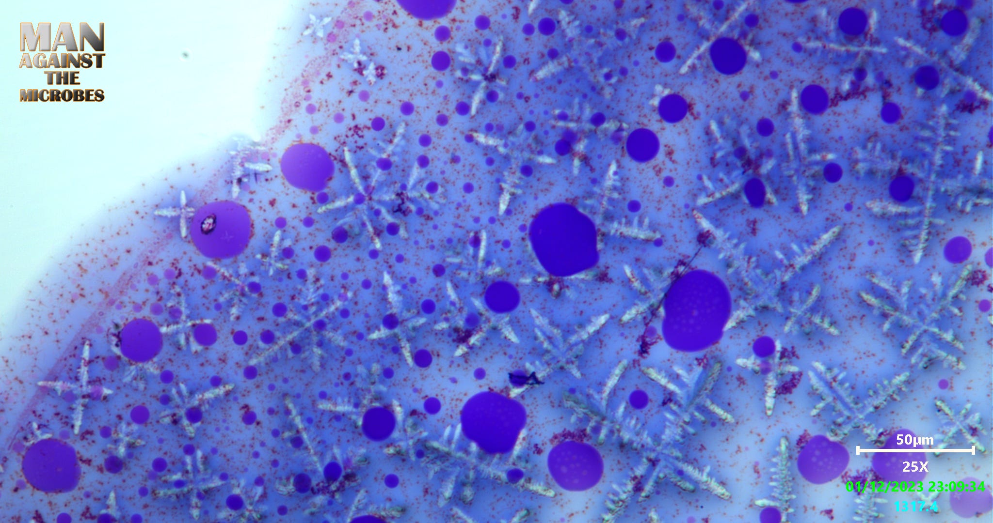WoW! Staining of the swab solution show amazing chemical transitions ...