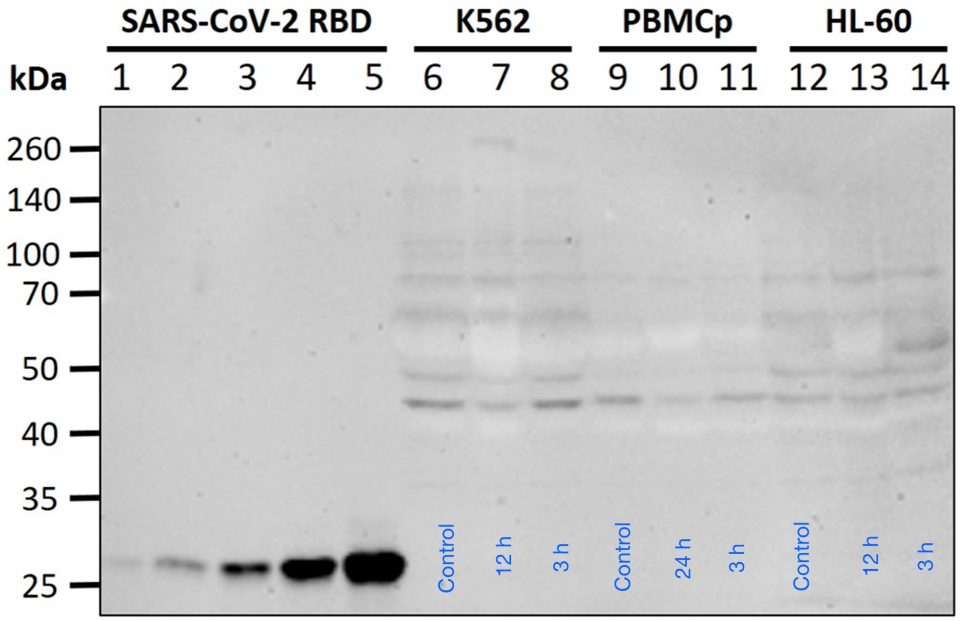 Myocarditis And Bolus Theory - by Brian Mowrey - Unglossed