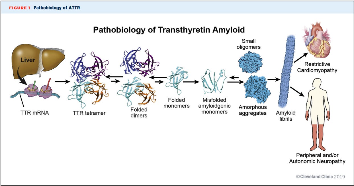 Amiloidose Cardíaca